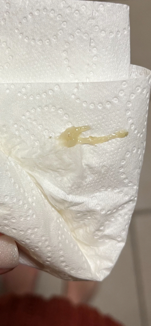 Is this normal cervical mucus? 5w1d - Glow Community
