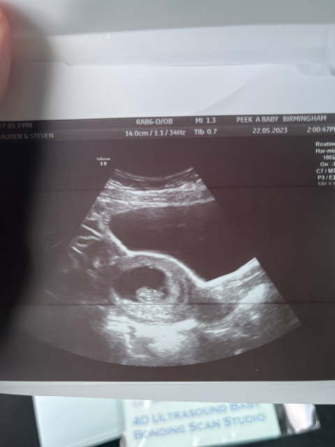 8 weeks 6 days abdominal scan - Glow Community